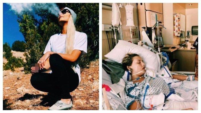 Wanita Ini Koma Selama 3 Tahun Setelah Gunakan Vape